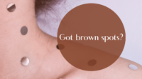 Brown Spots On Your Skin? | Here’s What You Need to Know